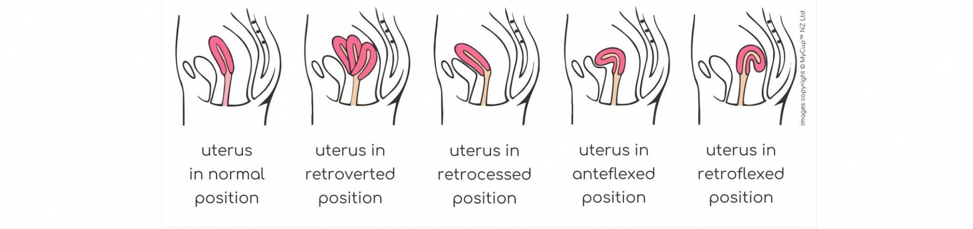 Search Results – Menstrual Cup